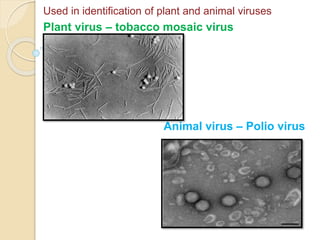 Electron microscope ppt | PPTX