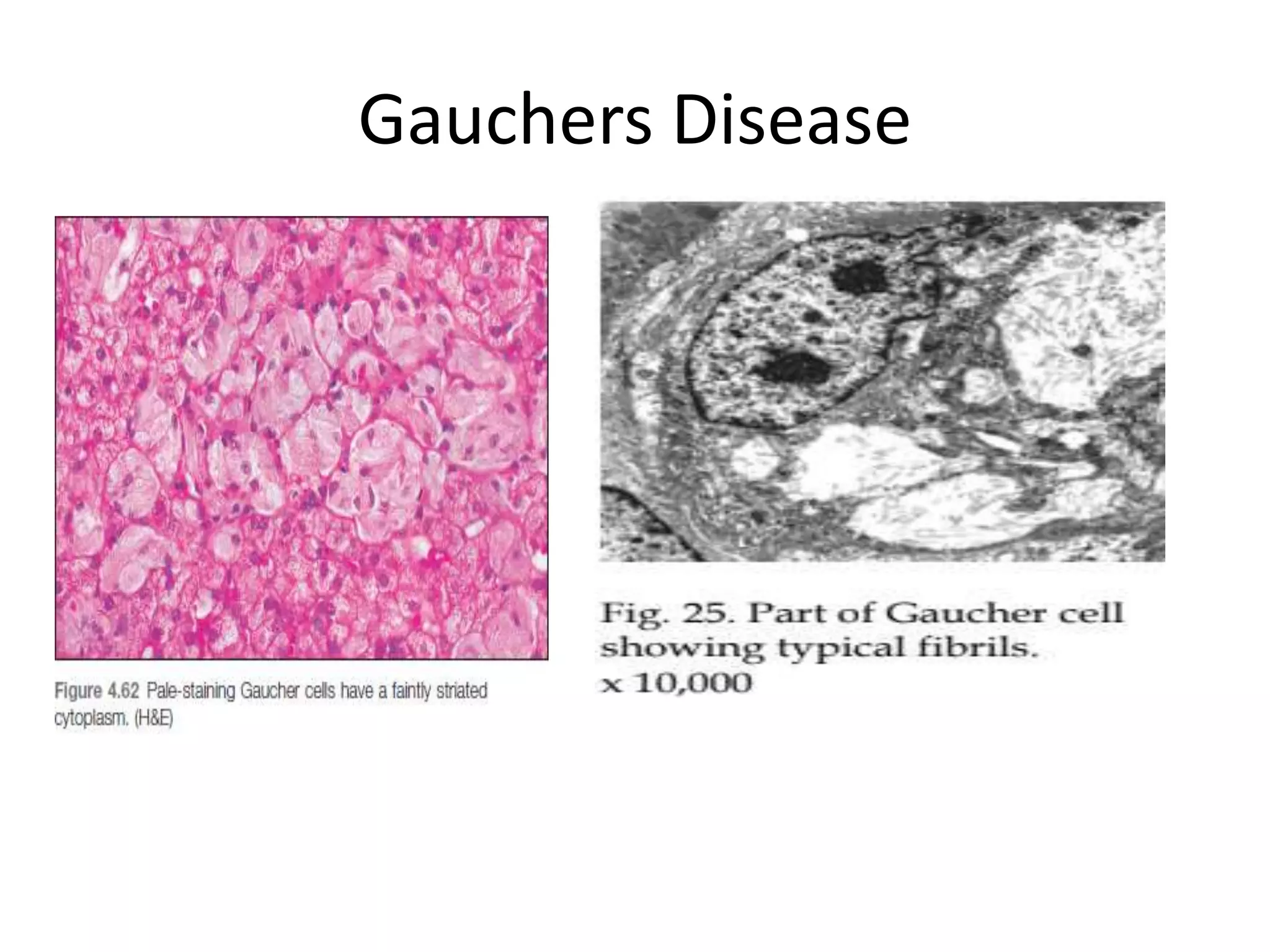 Electron microscopy of liver diseases- 2020 | PPTX