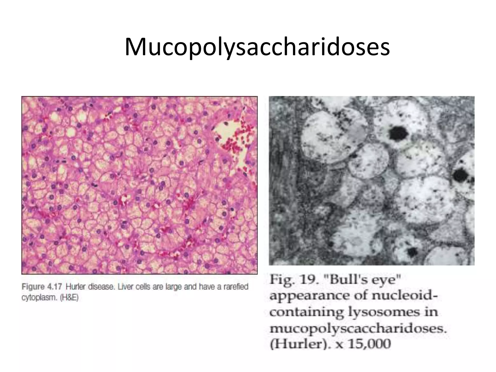 Electron microscopy of liver diseases- 2020 | PPTX