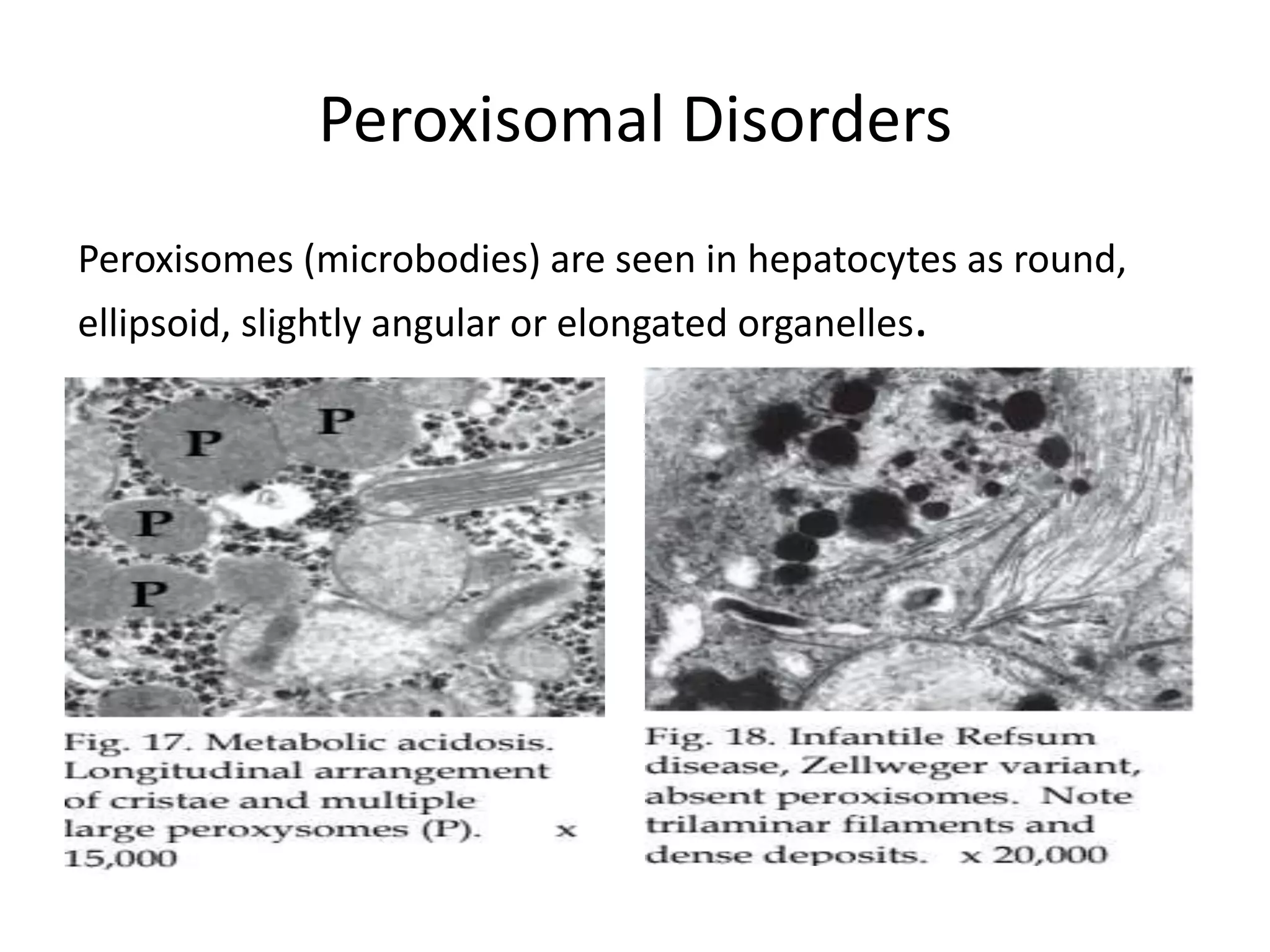 Electron microscopy of liver diseases- 2020 | PPTX