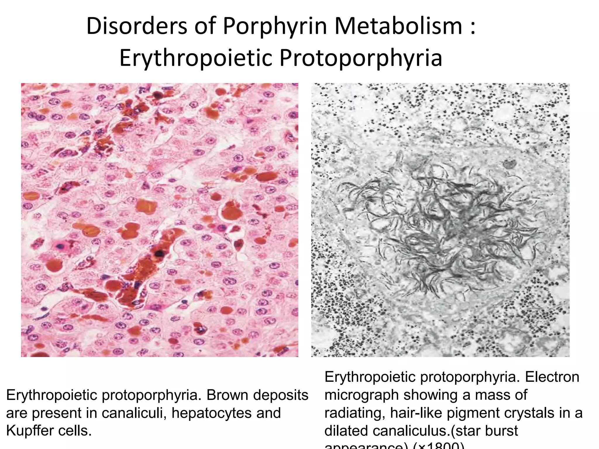 Electron microscopy of liver diseases- 2020 | PPTX