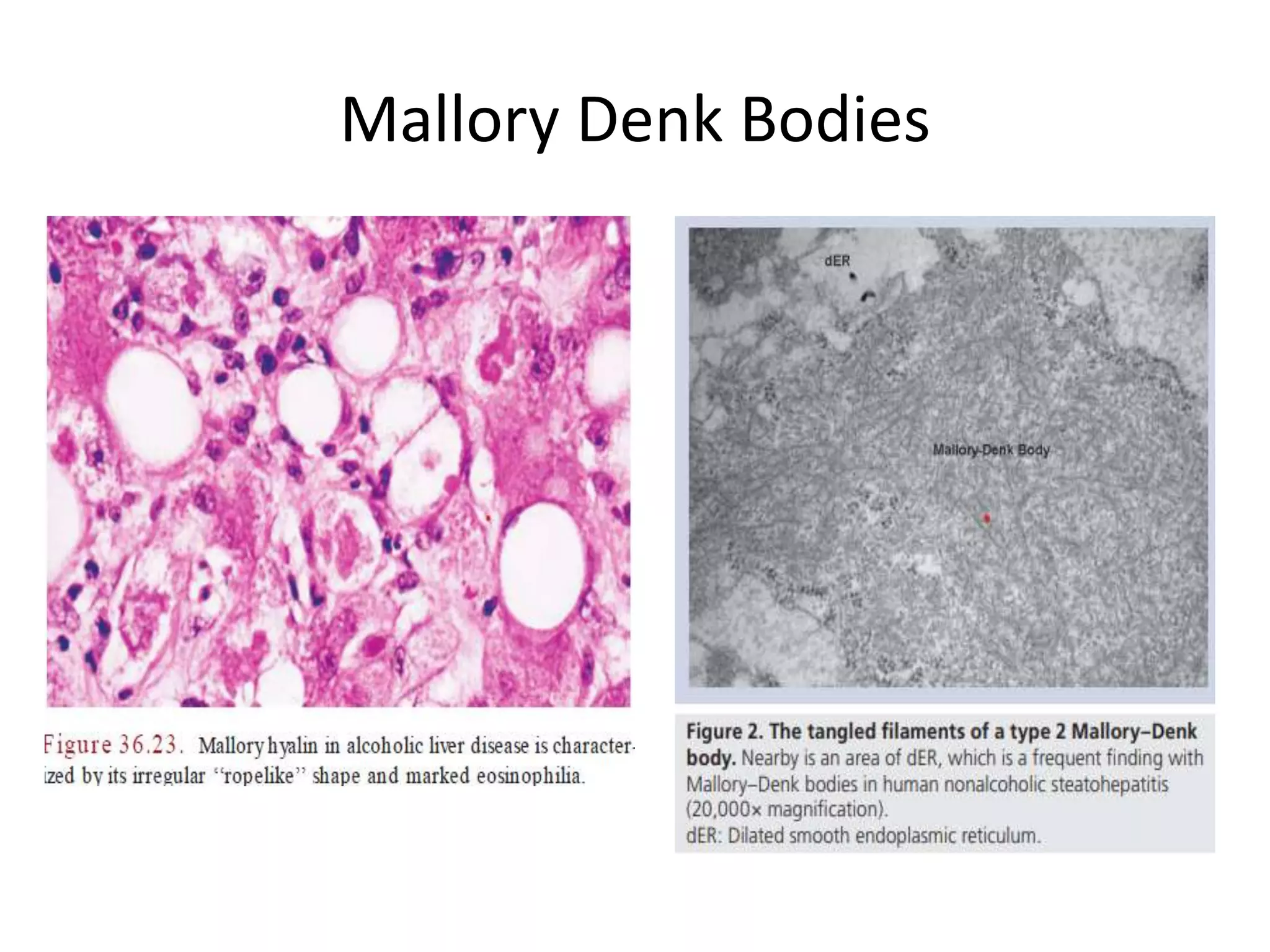 Electron microscopy of liver diseases- 2020 | PPTX