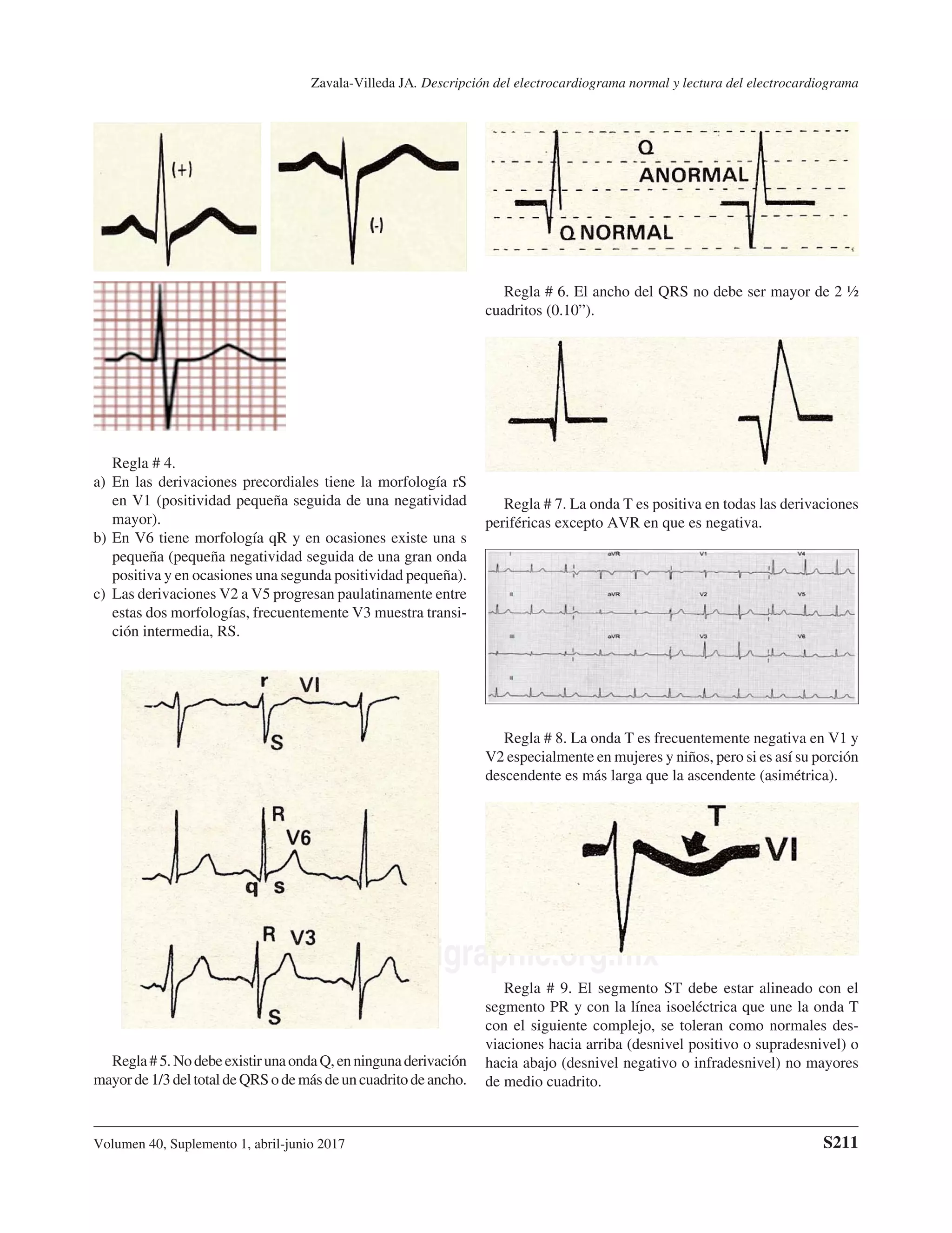 Electro normal.pdf