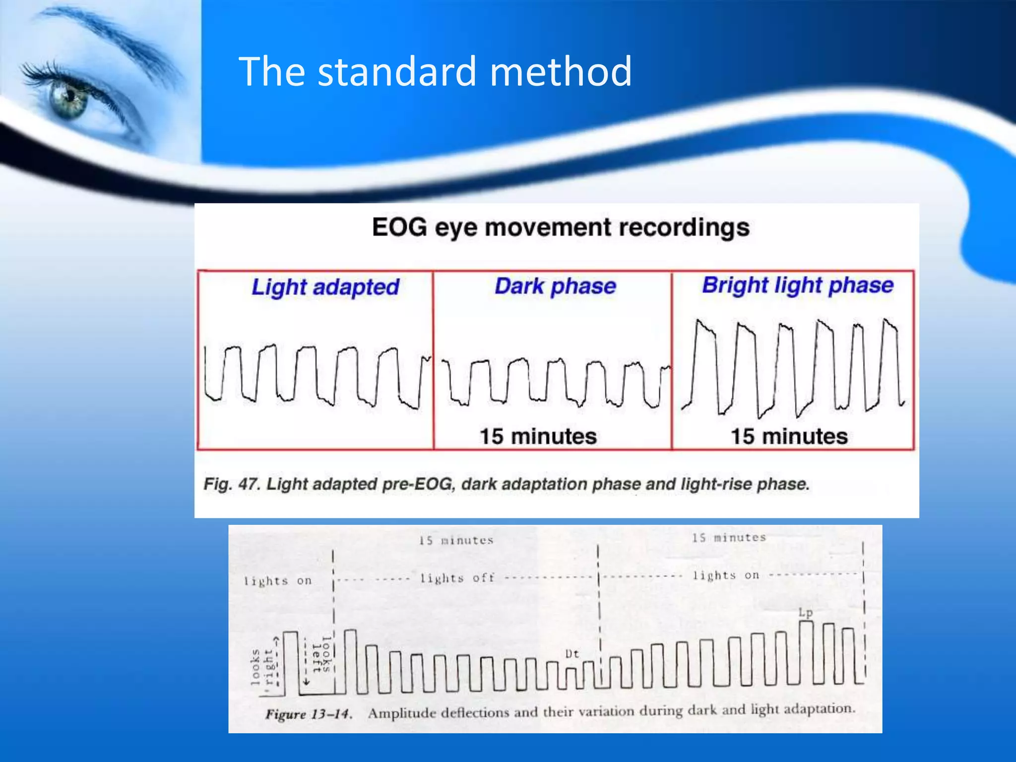 Electrooculogram- EOG | PPSX