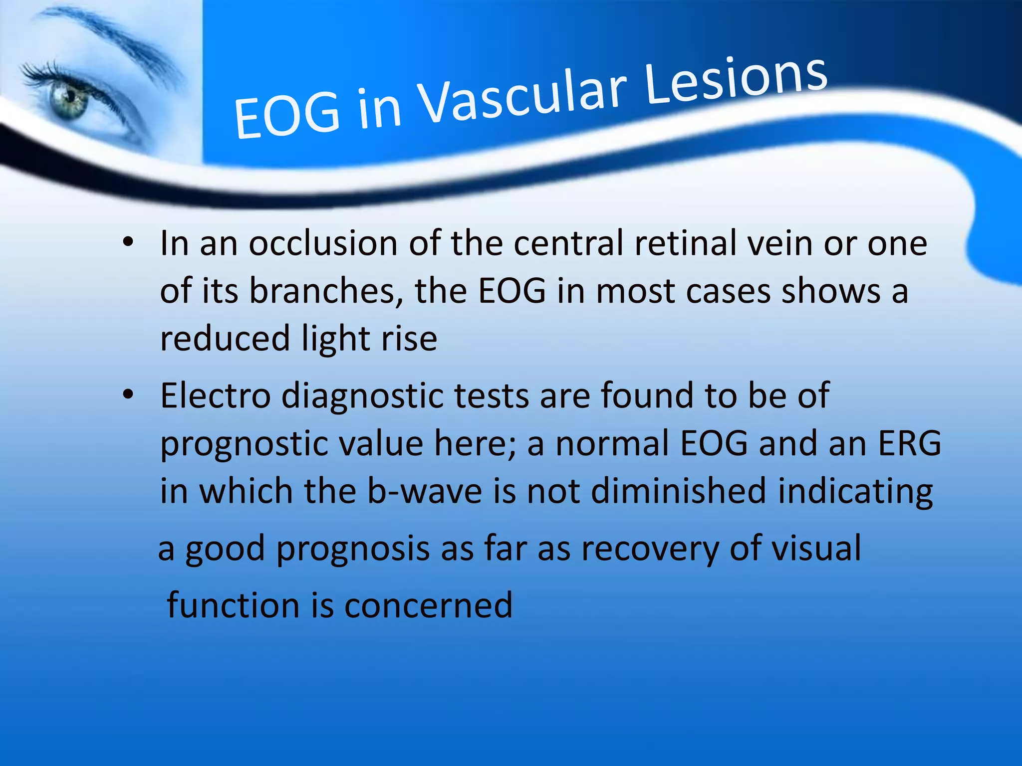 Electrooculogram- EOG | PPSX