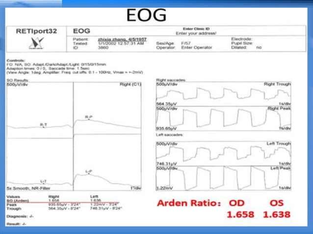 Electrooculogram- EOG | PPSX
