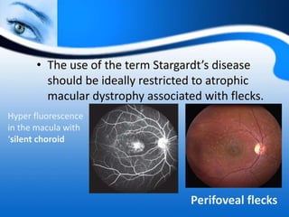Electrooculogram- EOG | PPSX