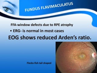 Electrooculogram- EOG | PPSX