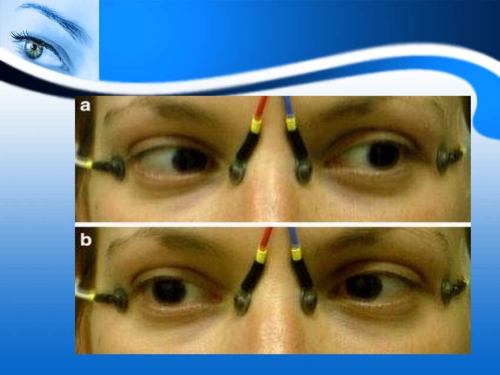 Electrooculogram- EOG