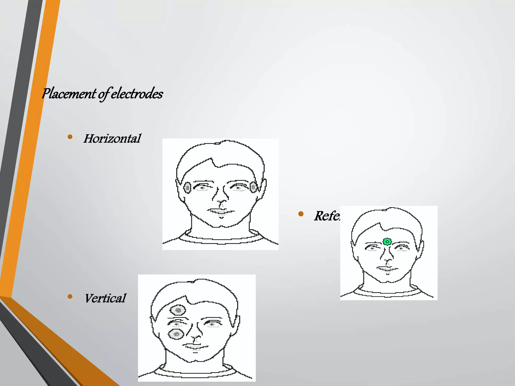 Electro oculography | PPTX