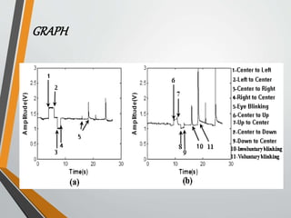 Electro oculography | PPTX