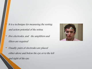 Electro oculography | PPTX