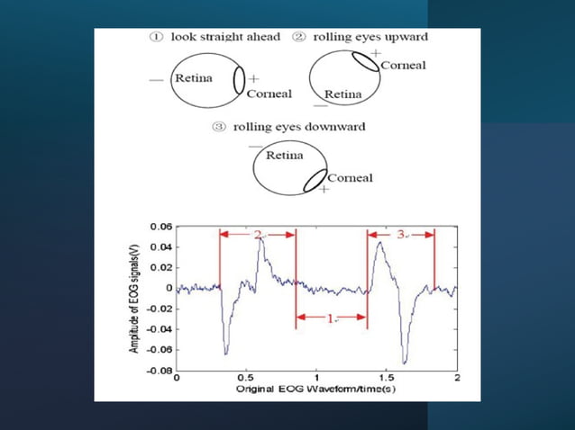 Brief Introduction on Electro Oculography-SSM.pptx