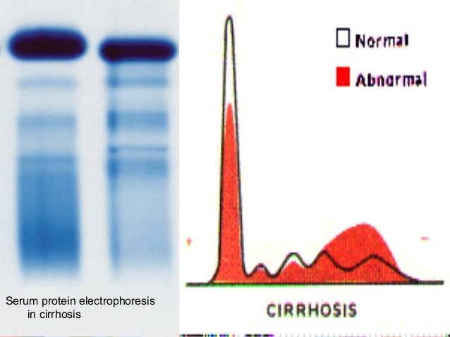 Electrophoresis