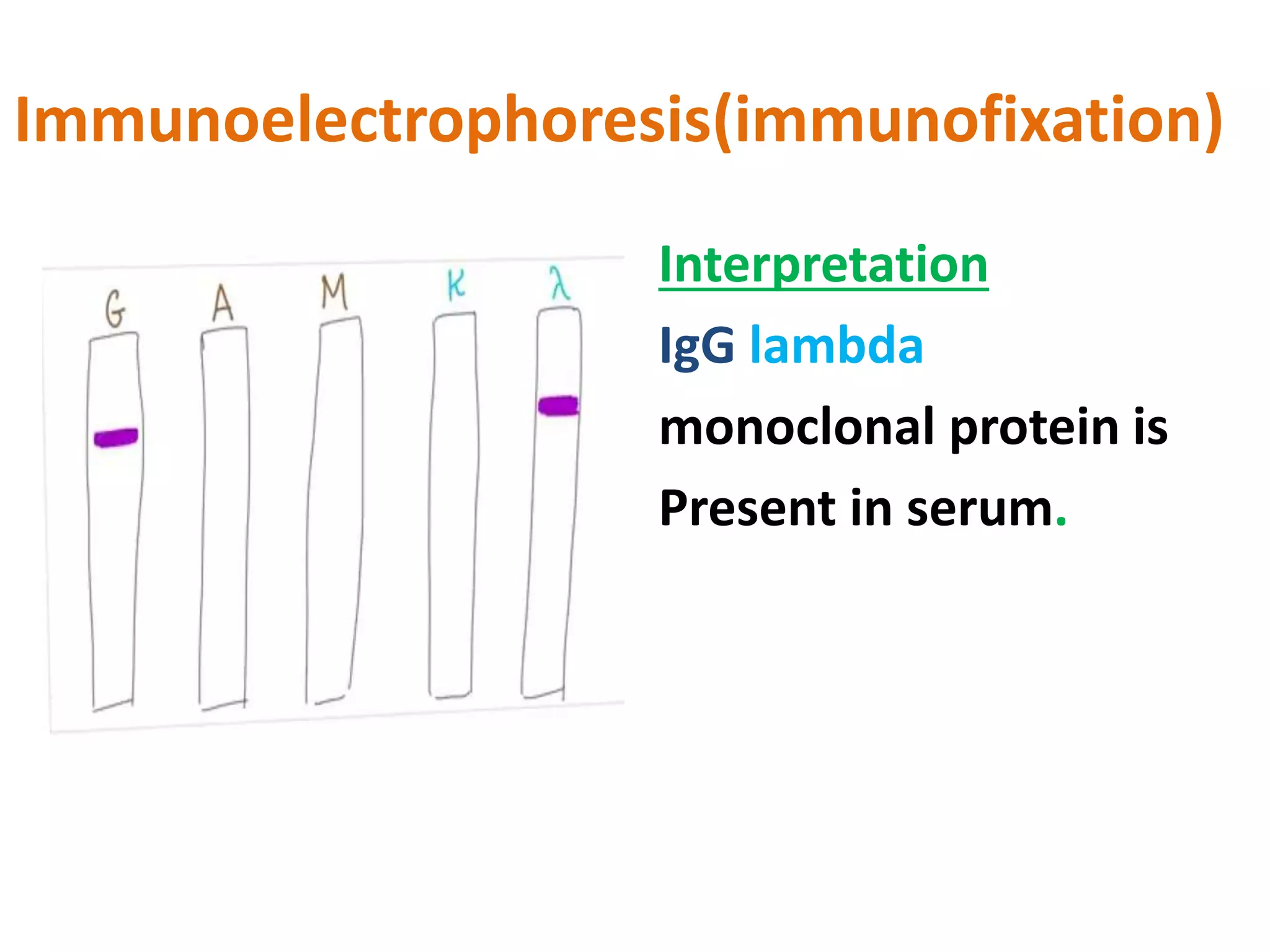 SD Electrophoresis and immunofixation | PPTX