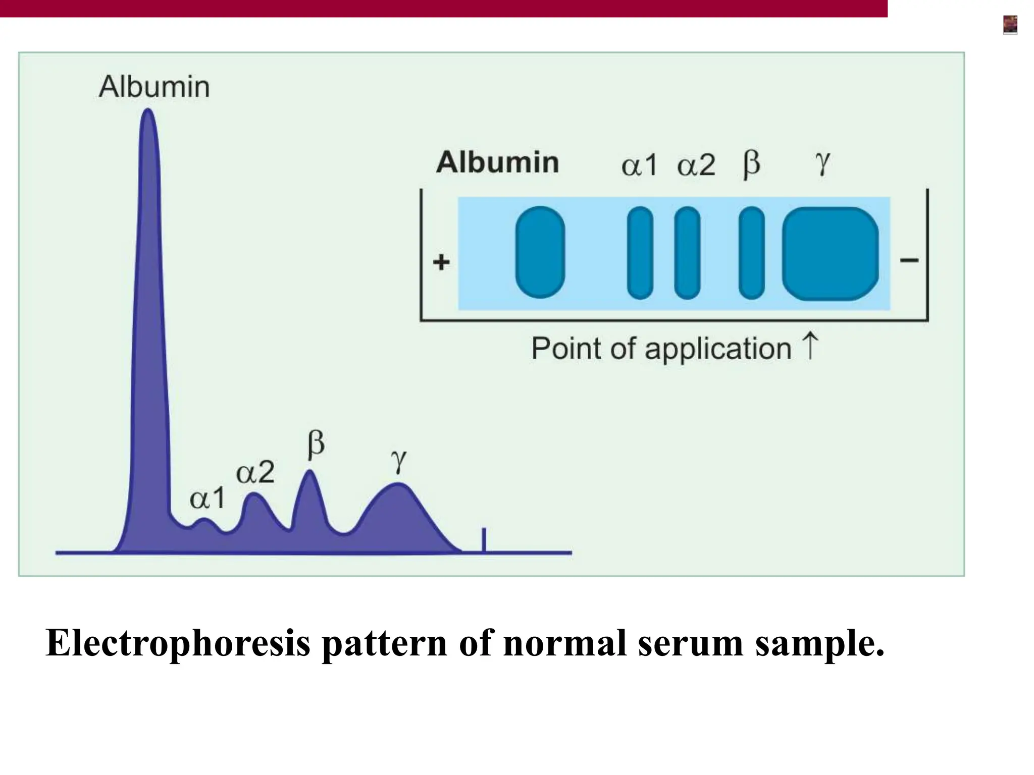 Electrophoresis in biochemistry practical.pptx | Chemistry | Science