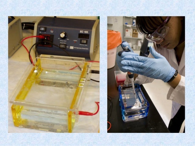 Gel Electrophoresis Lab
