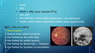 Electrophysiological Tests - ERG, EOG, VEP in ophthalmology.pptx