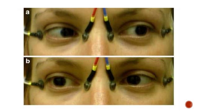 ELECTROPHYSIOLOGICAL TESTS OF THE EYE.pptx