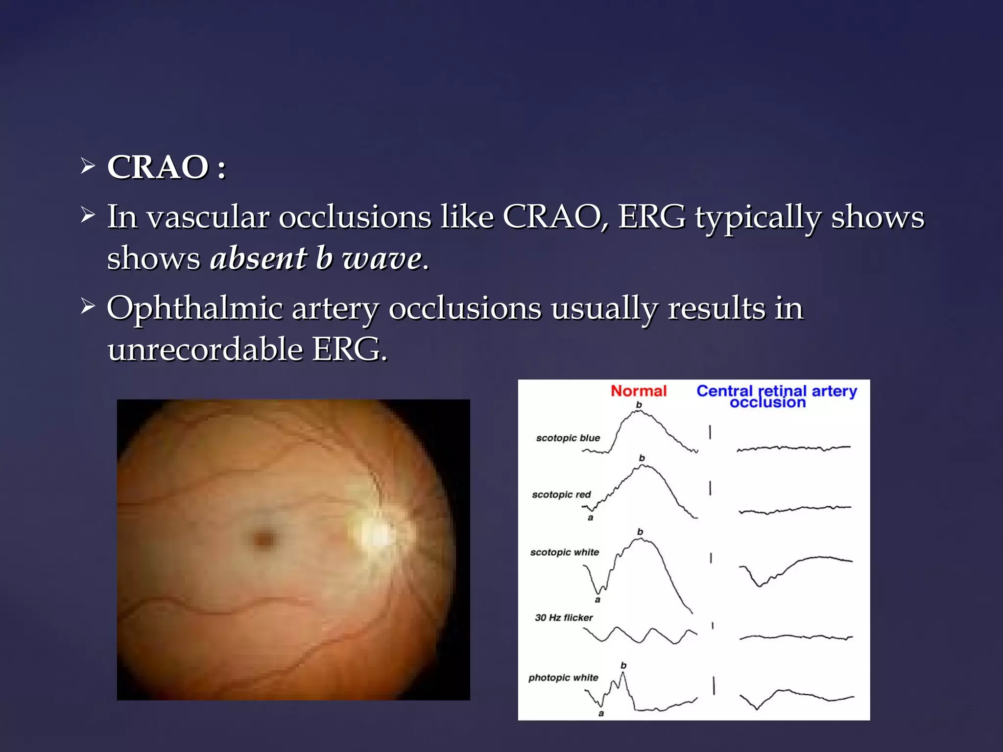 Electrophysiology | PPT