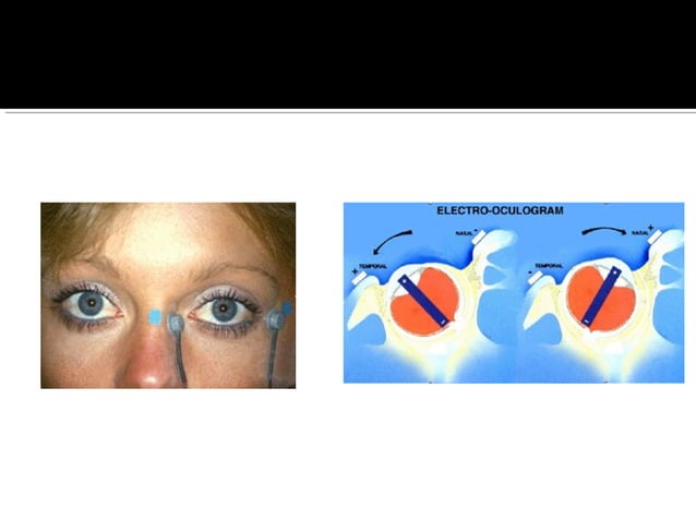 Electrophysiology | PPT | Eye and Vision Conditions | Diseases and ...