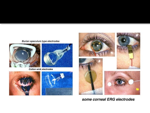 Electrophysiology | PPT | Eye and Vision Conditions | Diseases and Conditions