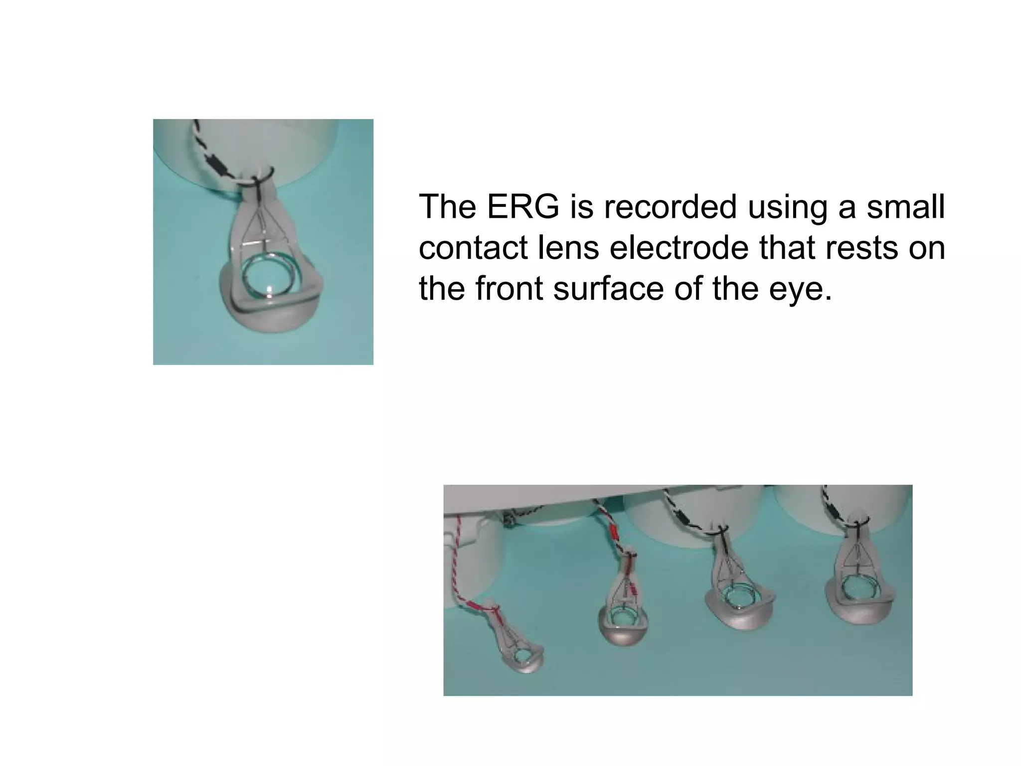 Electrophysiology: ERG & VEP | PPT