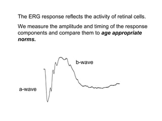 Electrophysiology: ERG & VEP | PPT