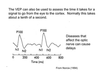 Electrophysiology: ERG & VEP | PPT