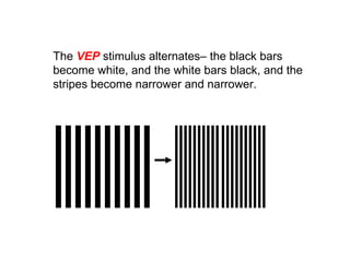 Electrophysiology: ERG & VEP | PPT