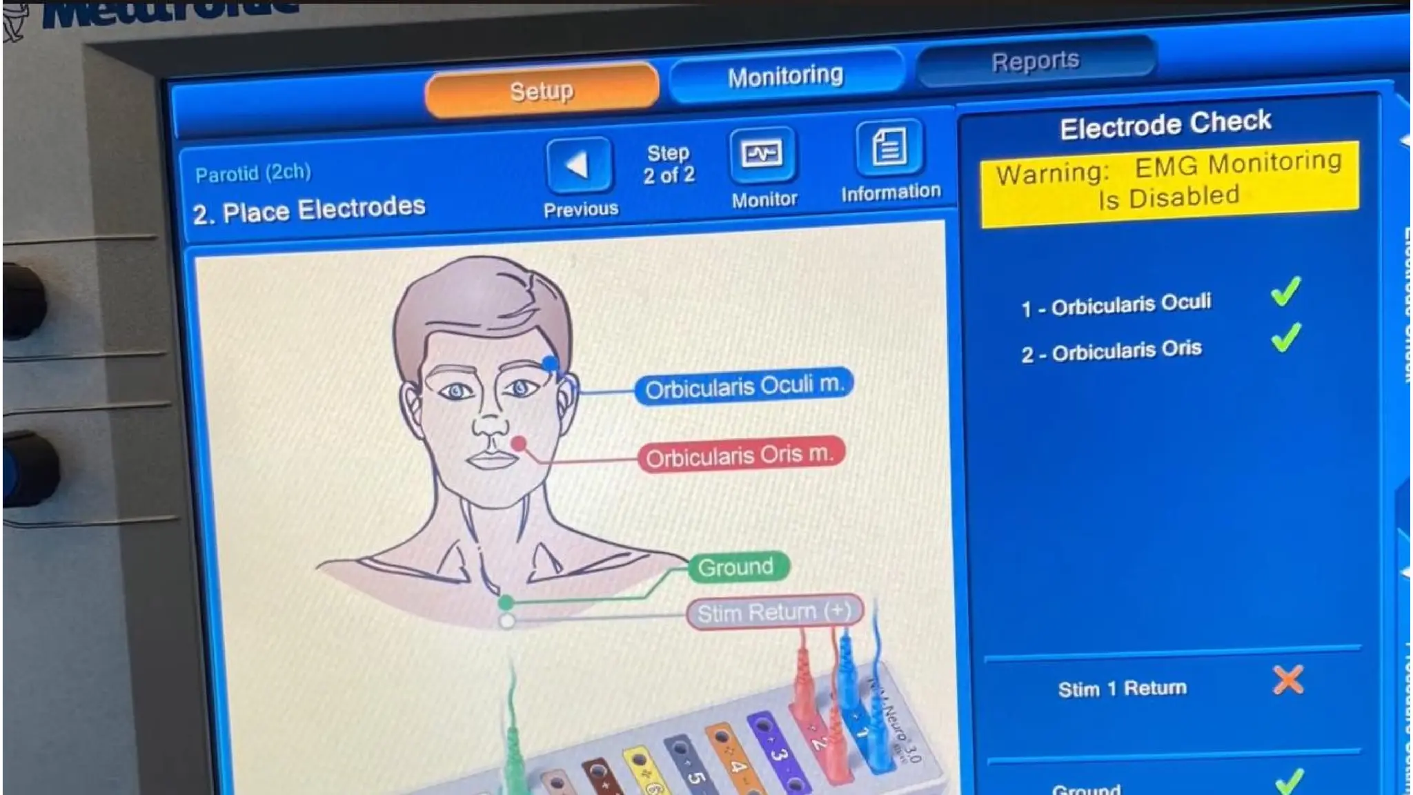 electrophysiology and monitoring of facial nerve.pptx