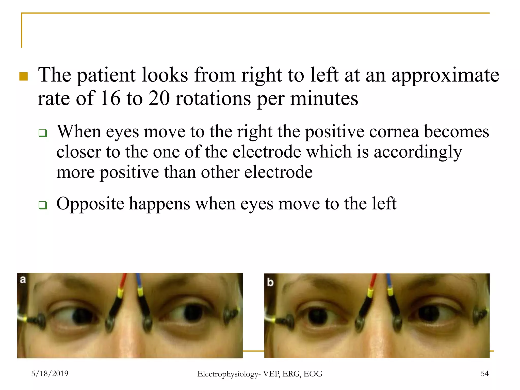 Electrophysiology VEP, ERG, EOG | PDF