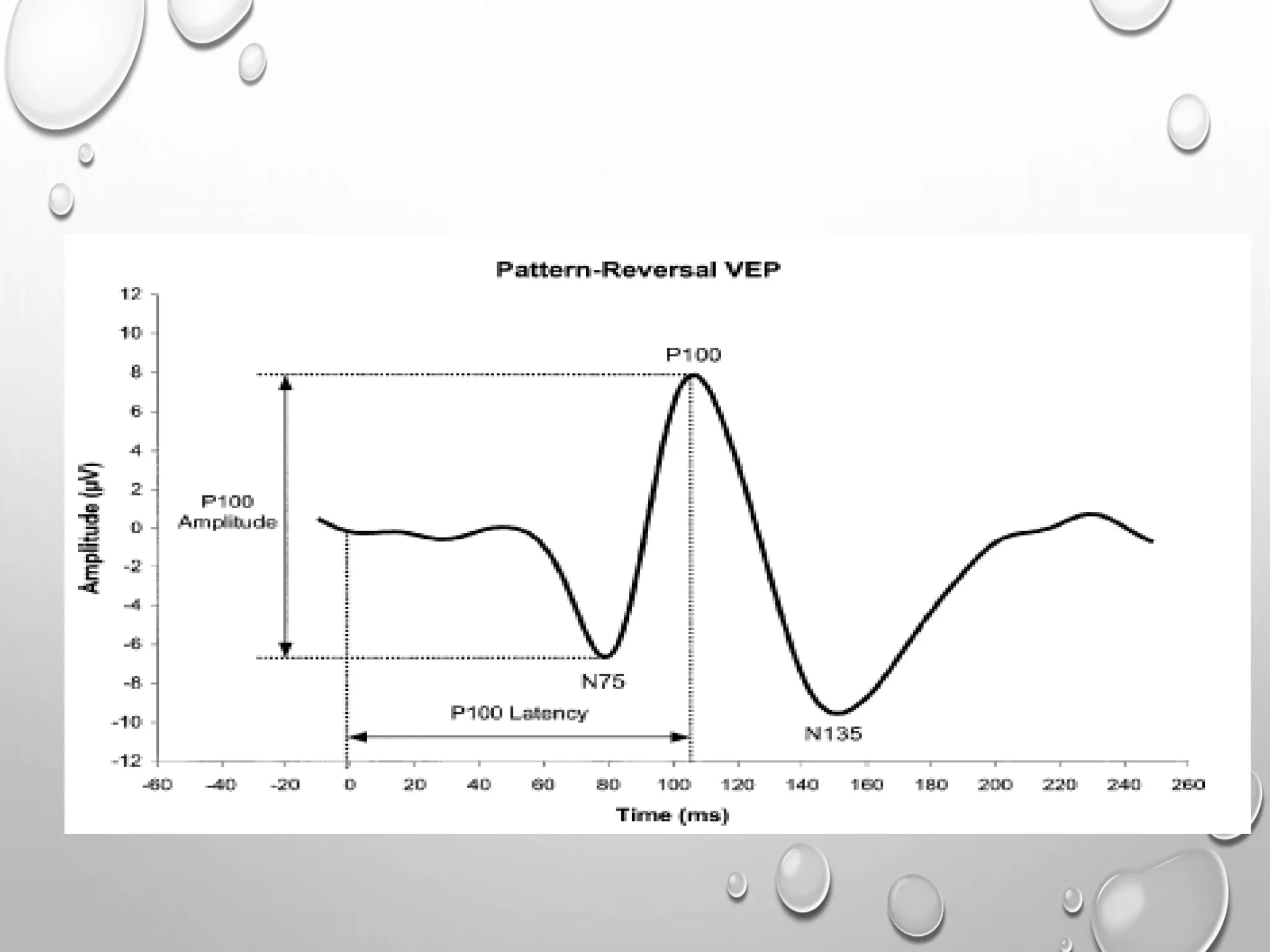 Electrophysiology VEP, ERG, EOG | PDF