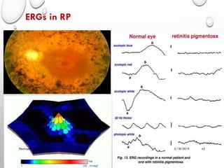 Electrophysiology VEP, ERG, EOG | PDF