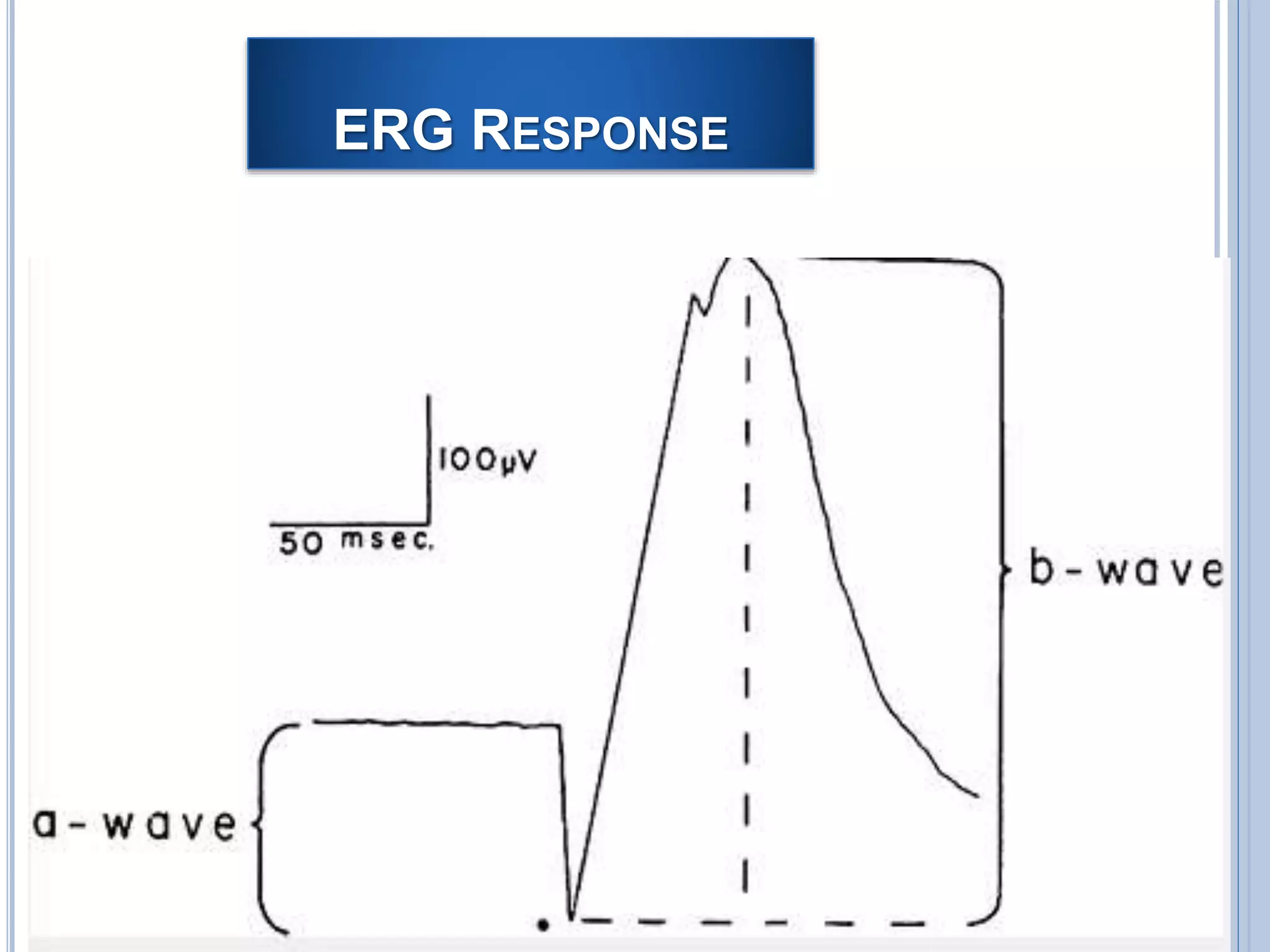 Electrophysiology in retinitis pigmentosa | PPTX