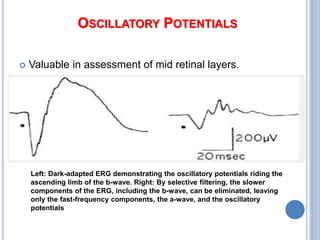 Electrophysiology in retinitis pigmentosa | PPTX