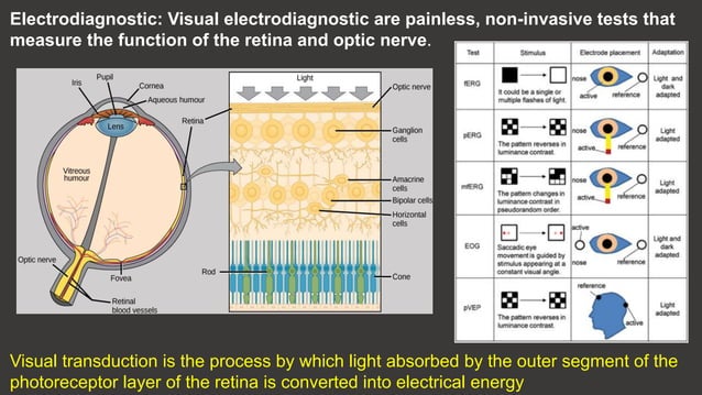 Electrophysiology (Electro-retinogram,Electro-oculogram, Visual evoked ...