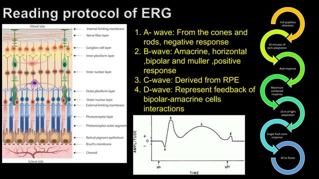 Electrophysiology (Electro-retinogram,Electro-oculogram, Visual evoked ...