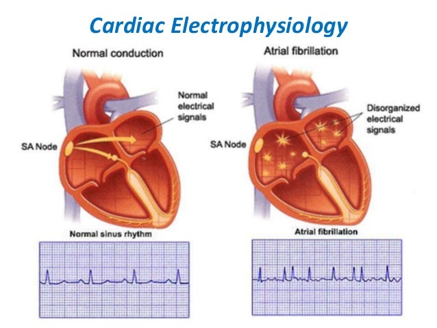 Electrophysiology of cardiac muscle