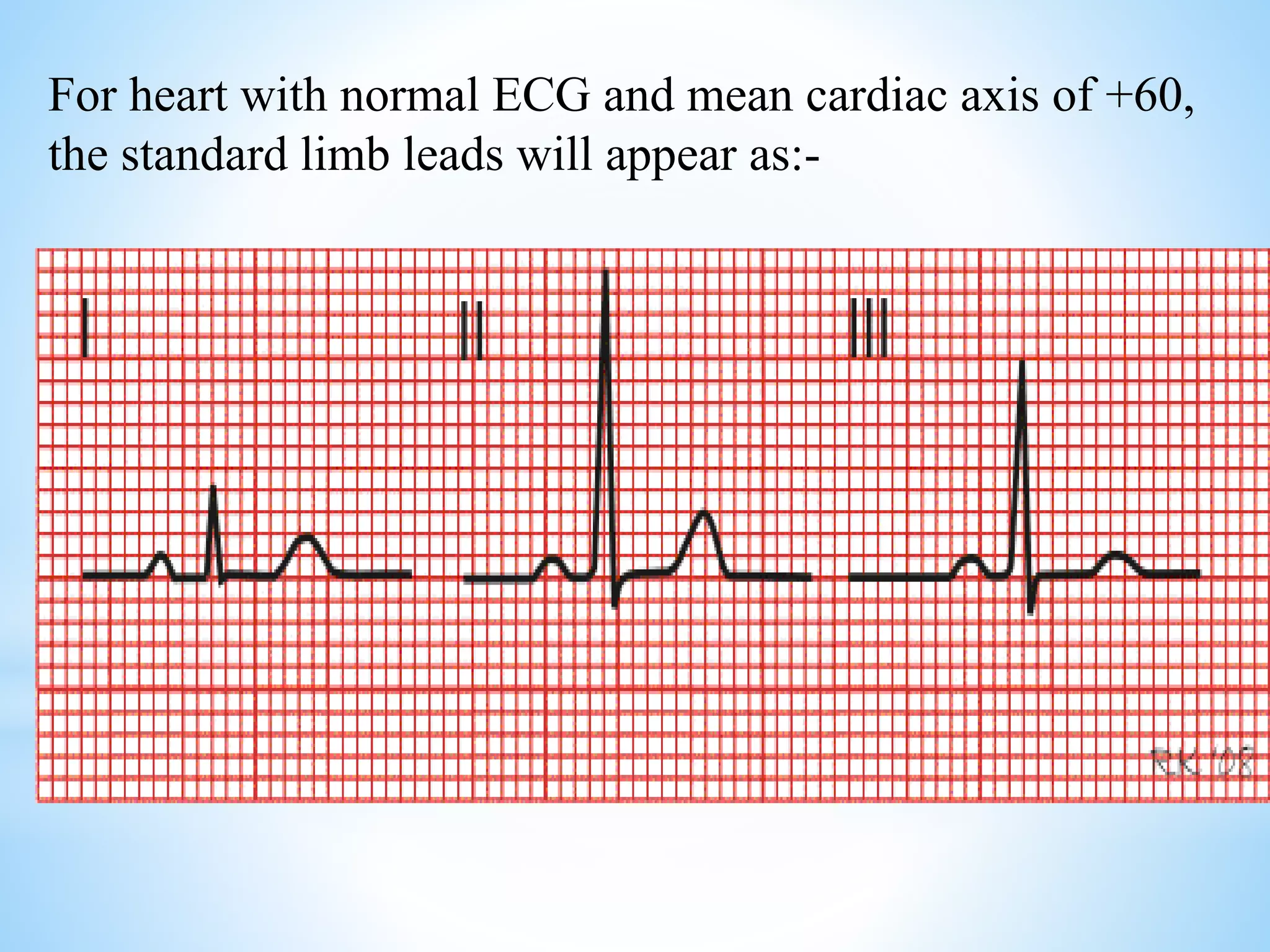 Electrophysiology of heart | PPTX