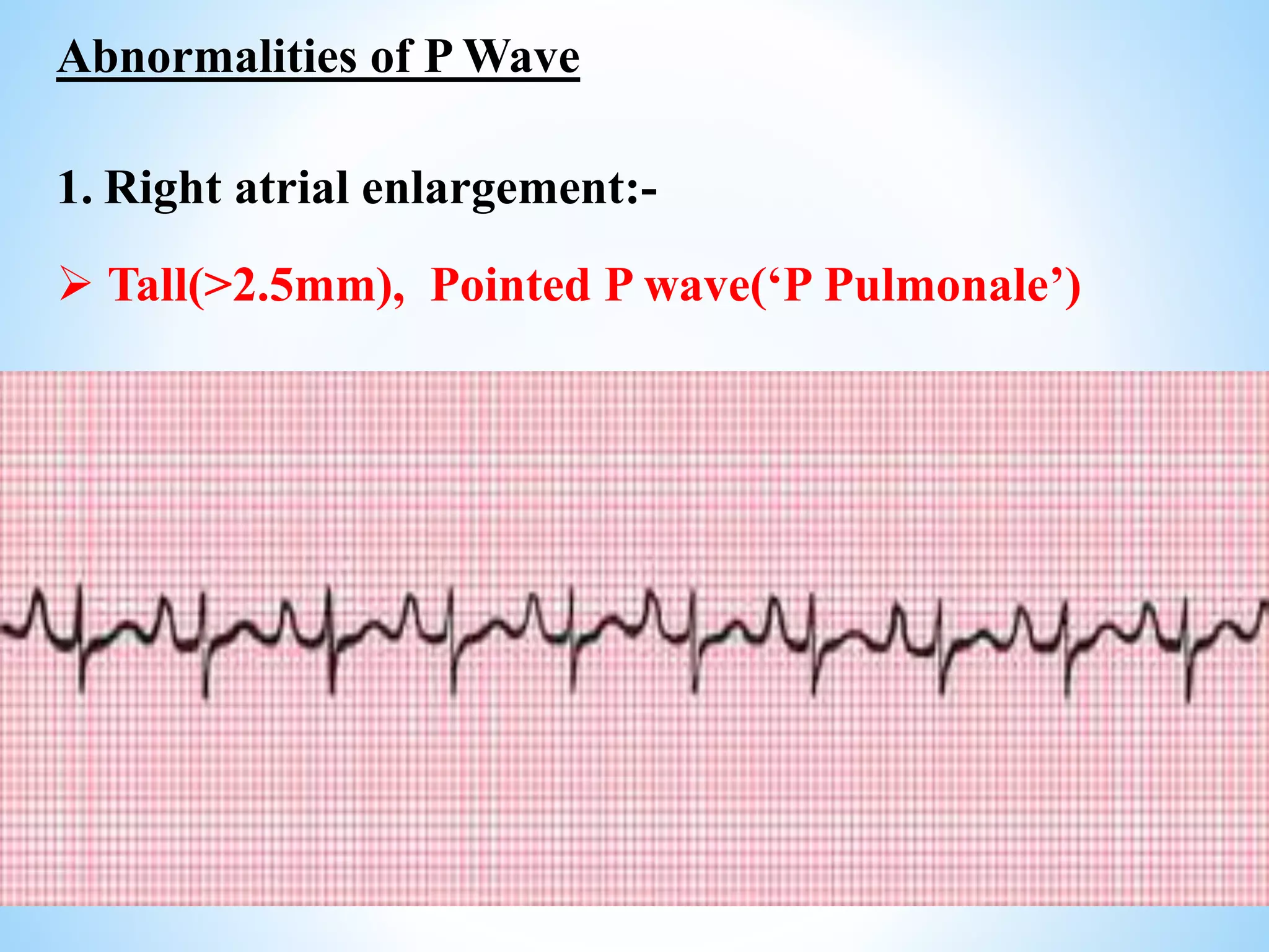 Electrophysiology of heart | PPTX