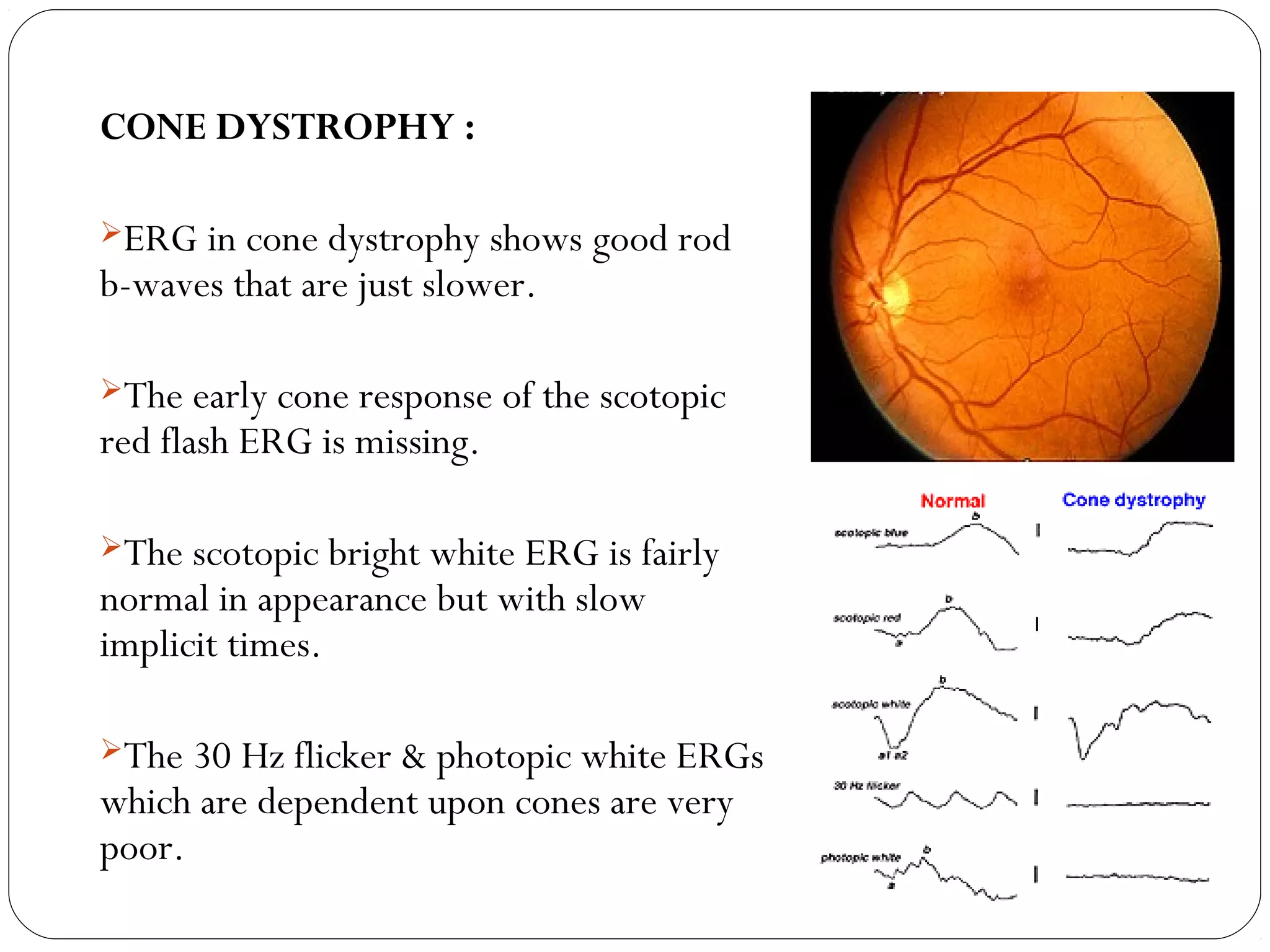 Electrophysiology in Ophthalmology | PPT