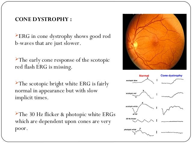 Electrophysiology in Ophthalmology