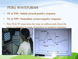 Electroretinogram (erg) | PPTX