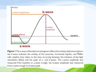 Electroretinogram (erg) | PPTX