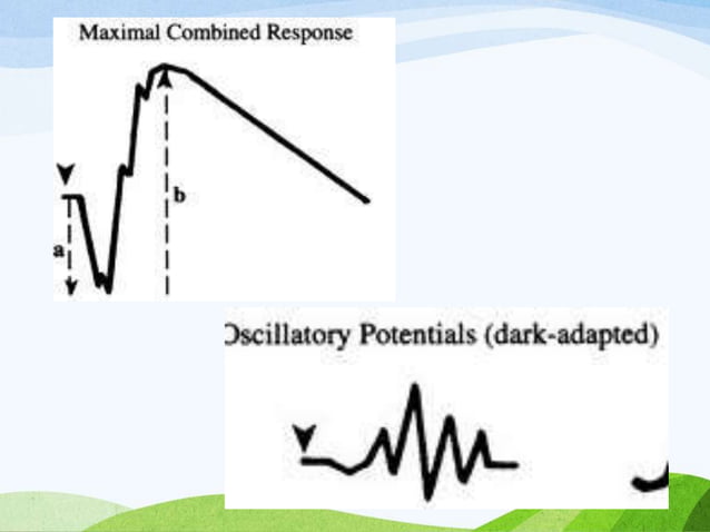 Electroretinogram (erg) | PPTX | Eye and Vision Conditions | Diseases ...