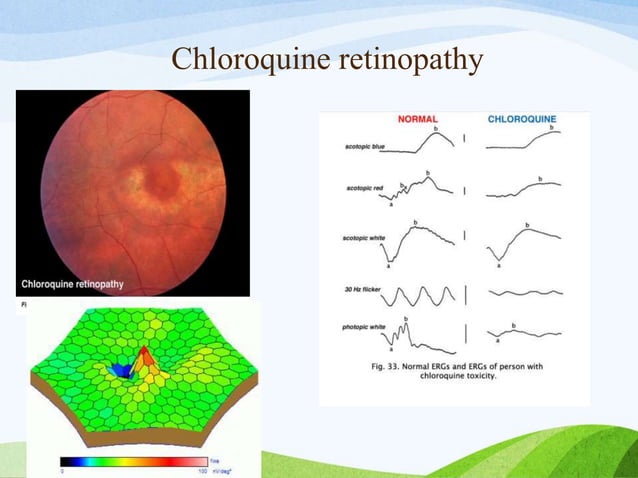 Electroretinogram (erg) | PPTX | Eye and Vision Conditions | Diseases ...