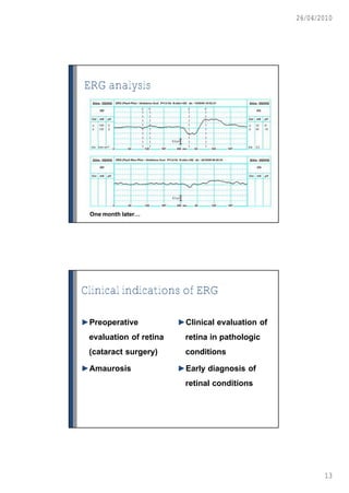 Electroretinography | PDF