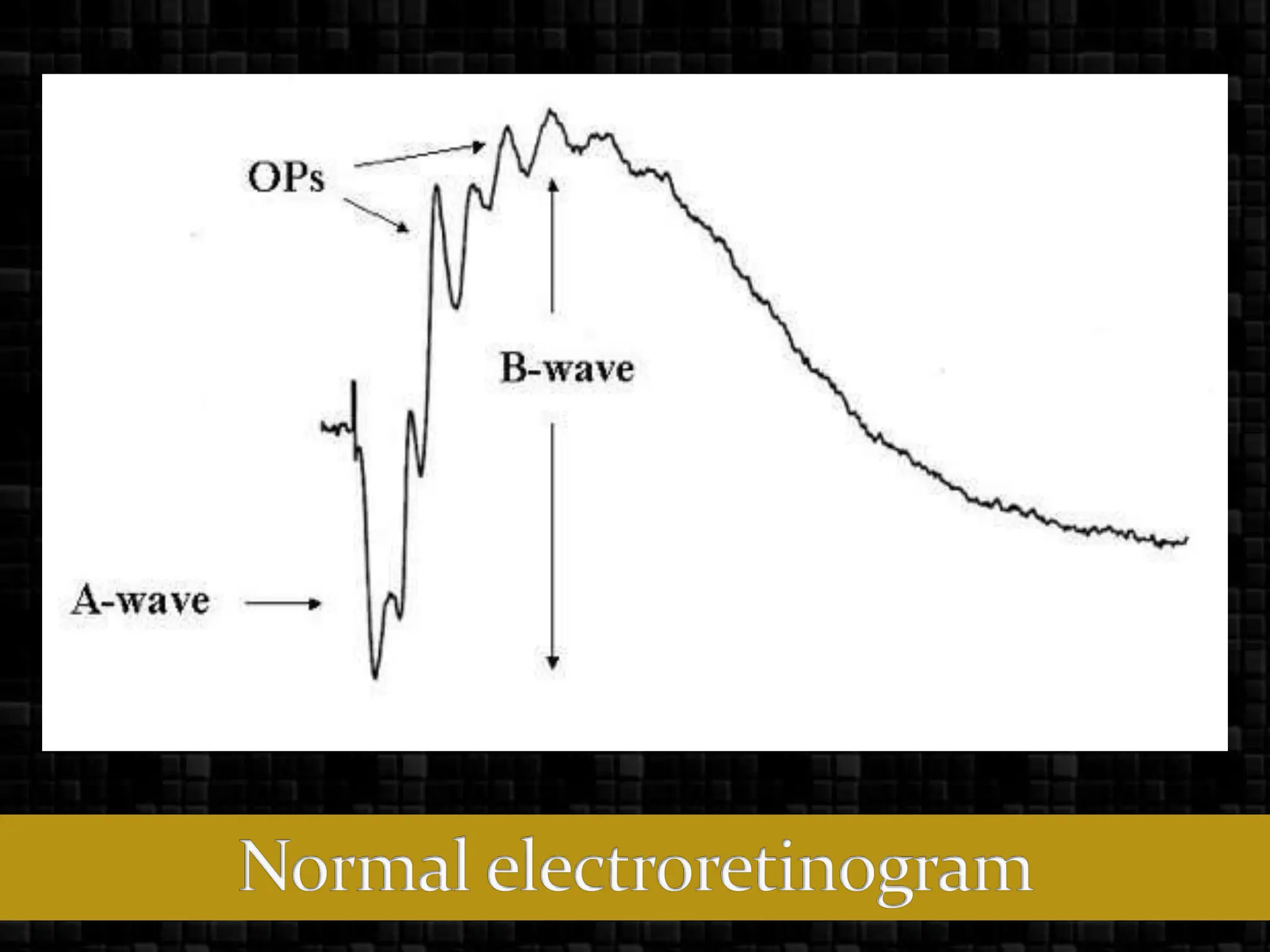 ELECTRORETINOGRAPHY (in veterinary).pptx