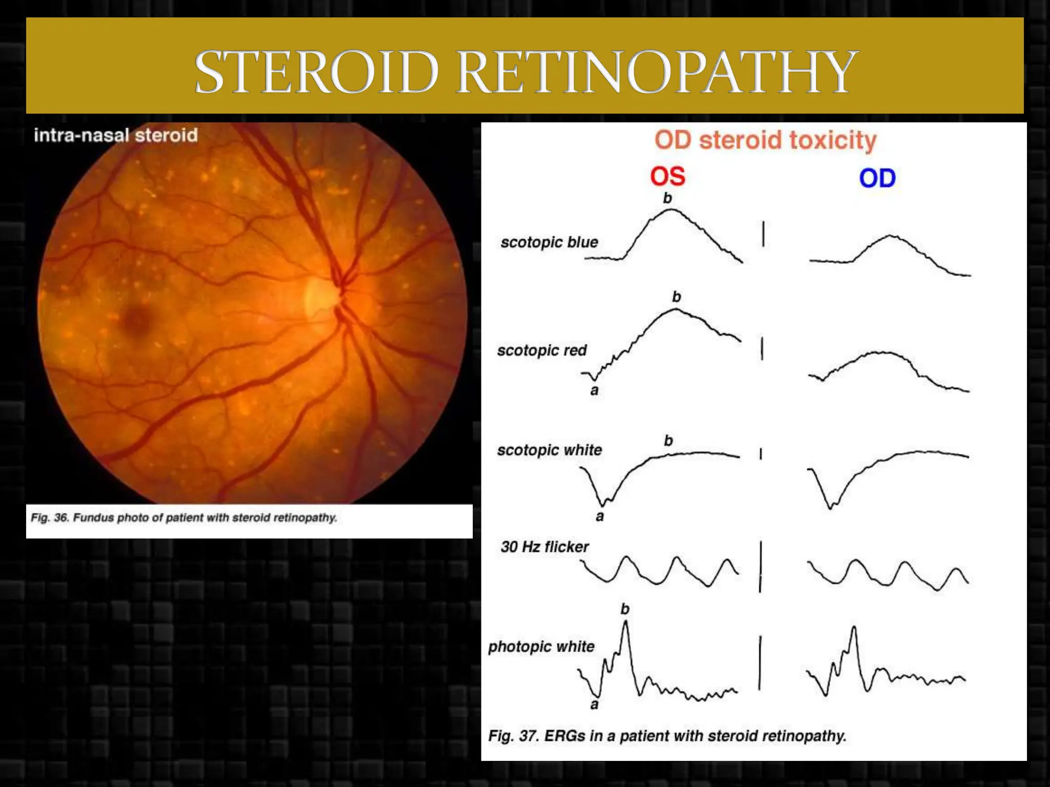 ELECTRORETINOGRAPHY (in veterinary).pptx